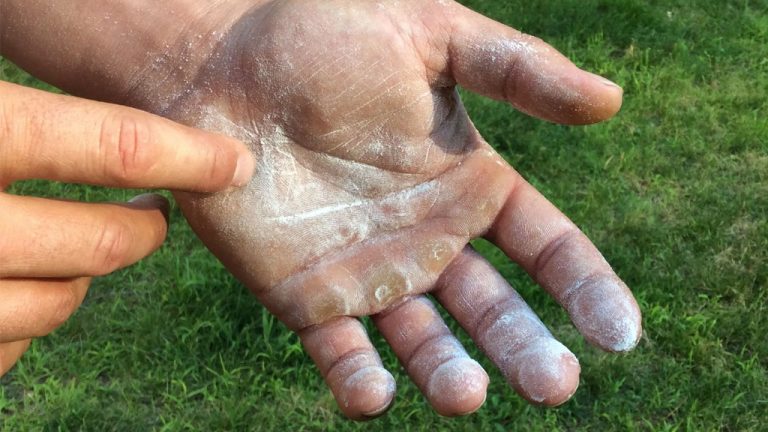 How To Deal With Calluses and Care For Your Hands - Adaptive Strength